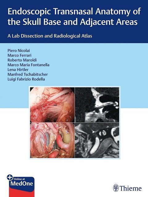 Endoscopic Transnasal Anatomy of the Skull Base and Adjacent